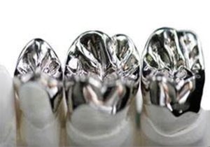 Metal Crowns – Crown and Bridgesental Pro