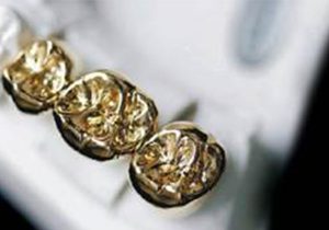 All resin dental crowns – Crown and Bridgesental Pro